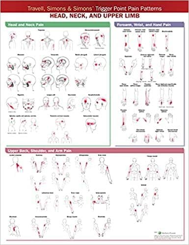Trigger points pain chart - Head neck & Upper limb