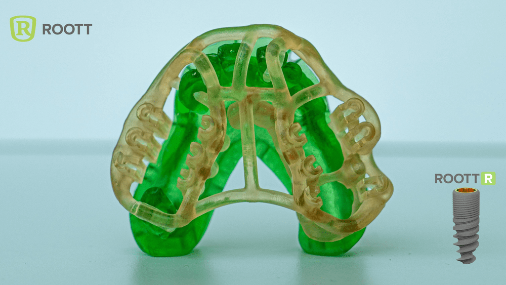 Guided Surgery - Open Guide for simplicity