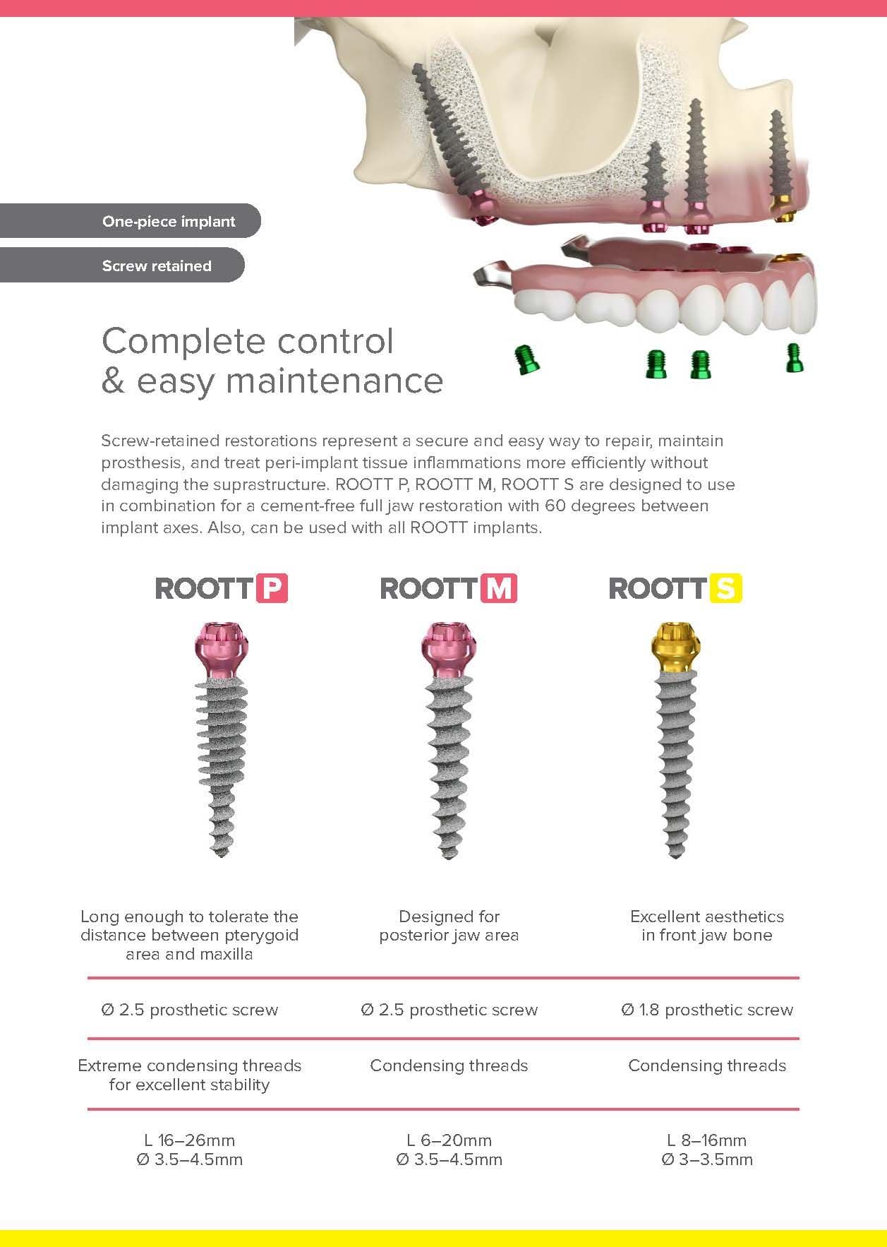 Workflow ROOTT P - Tissue level Implant