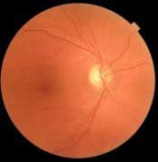 Stokes Opticians Optical Coherence Tomogrpahy