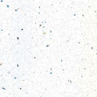 Brilliant White Sparkle 8681 SQ
