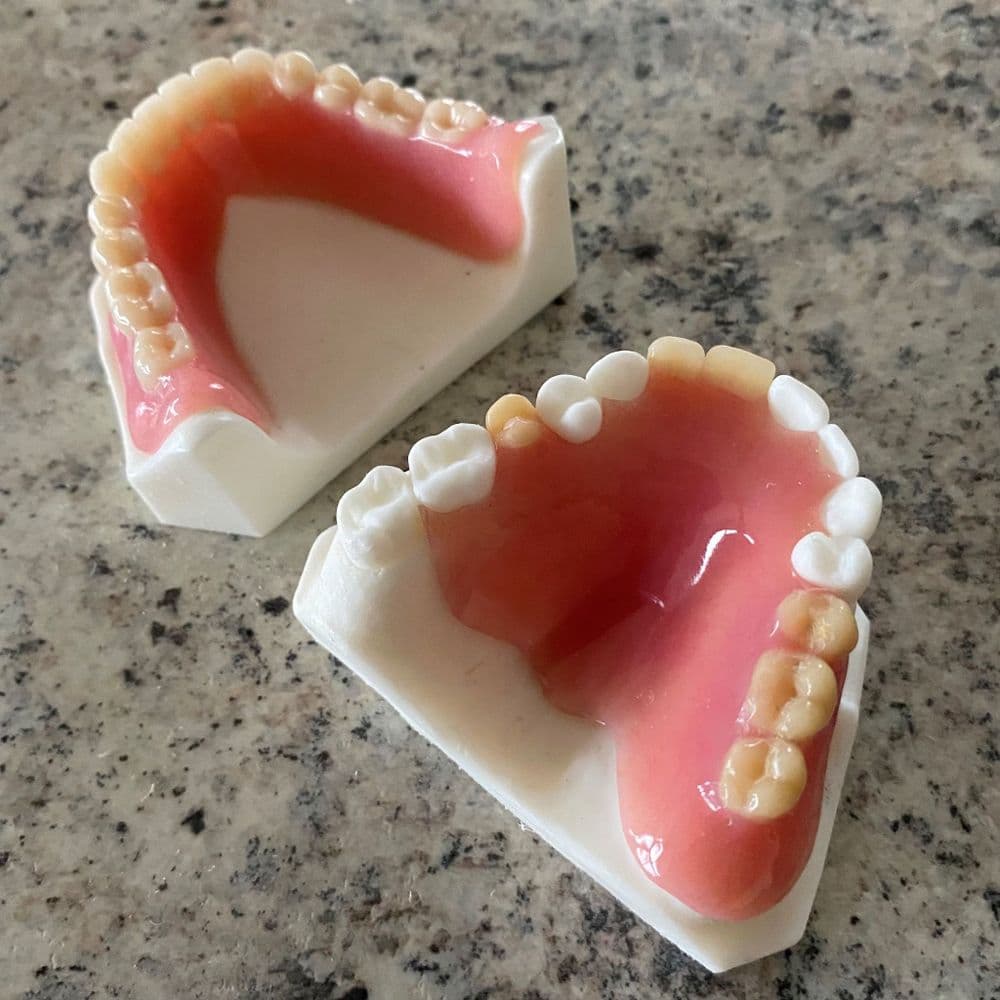 Teaching Denture Model - Partial upper