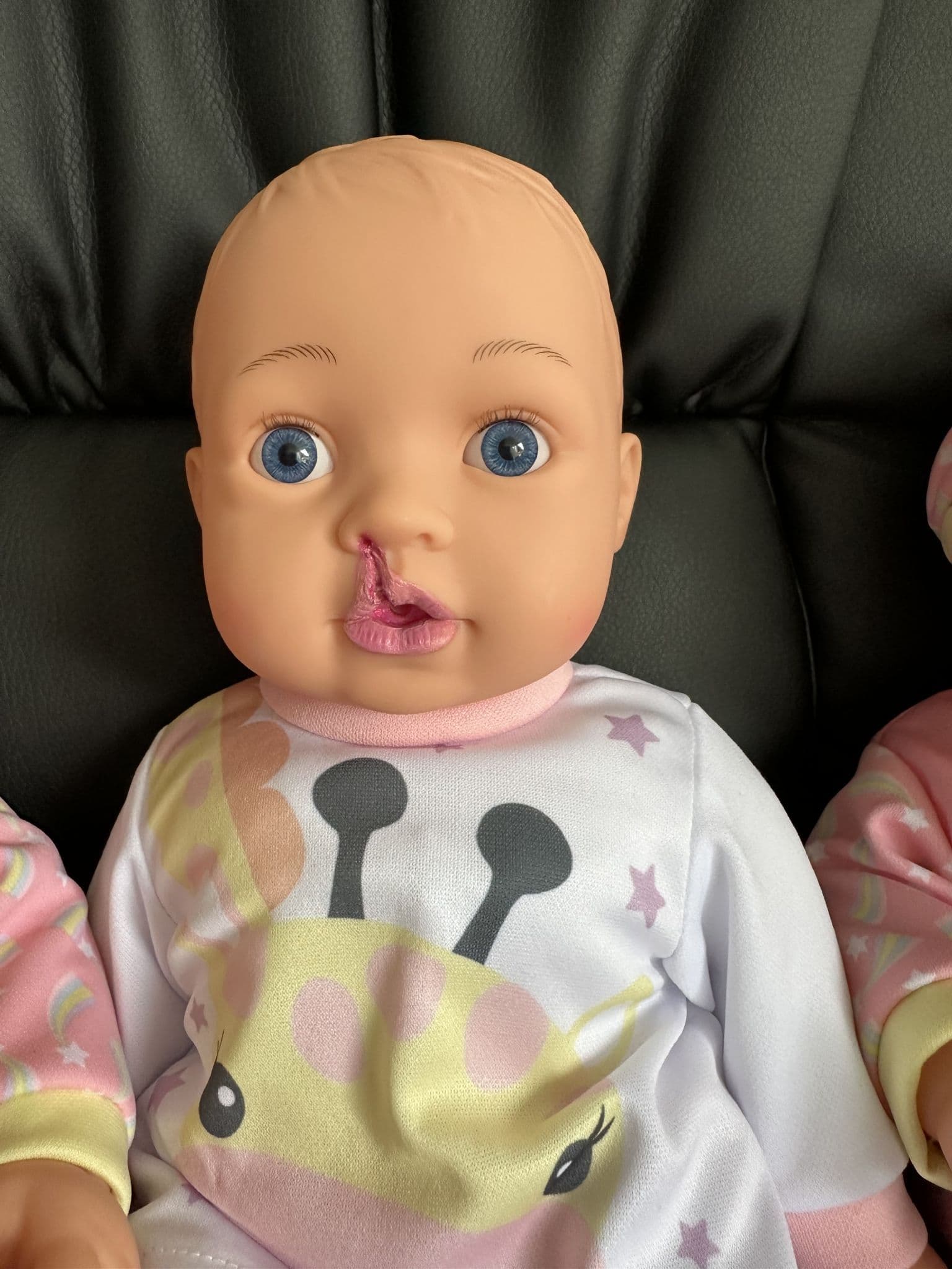 Cleft Lip Doll